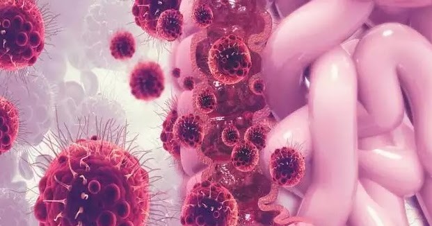 Colon Infection (Colitis): Causes, Types, Symptoms, Treatment : BizGlob