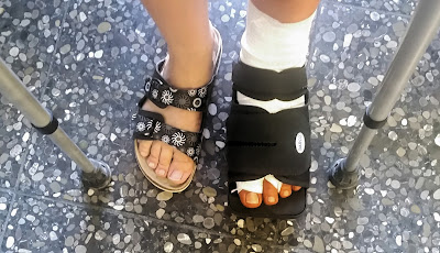 Pożegnanie z halluksami: Praktyczne porady przed operacją haluksa