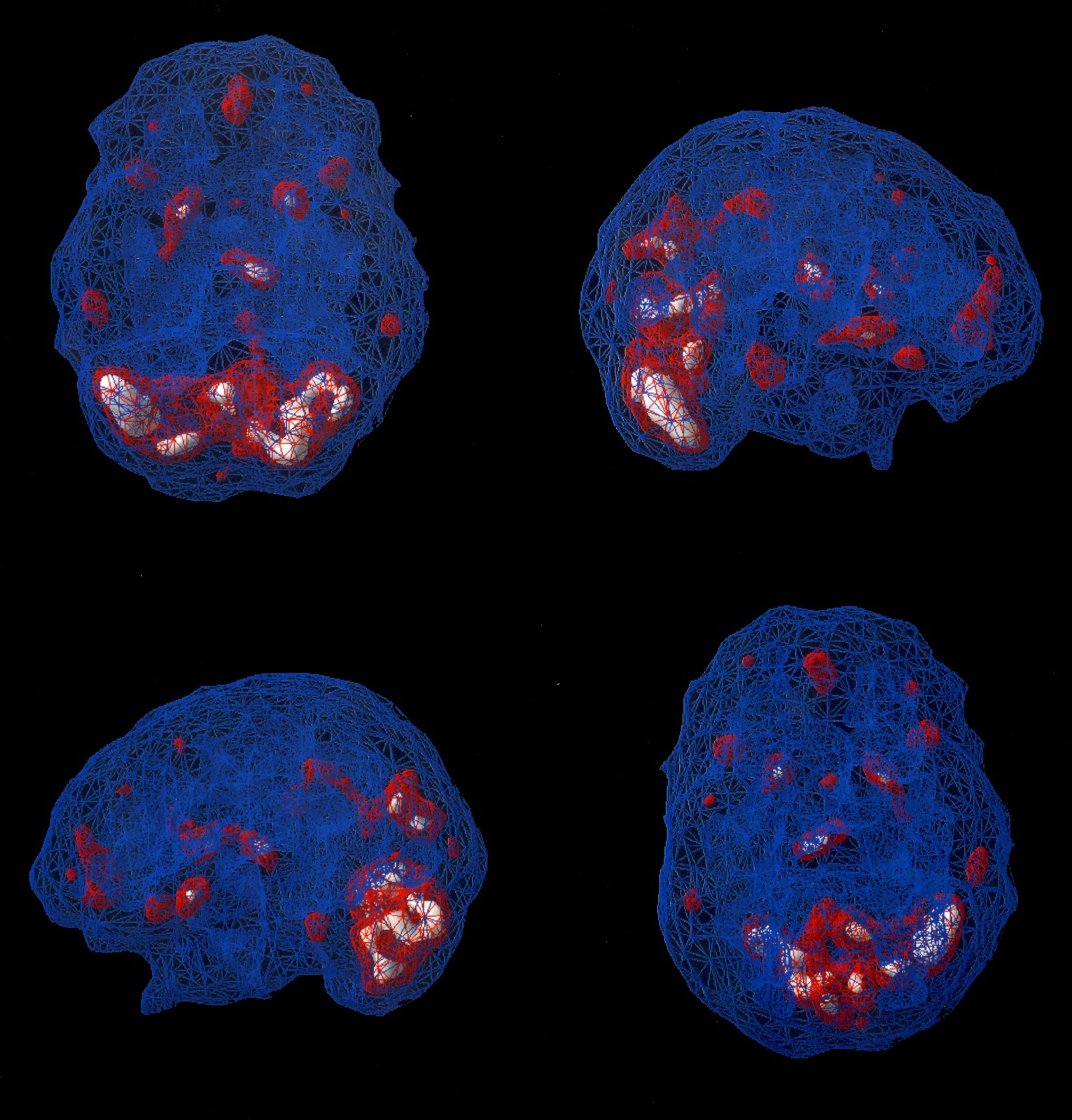 Snapshot of the pieces: Brain Scan & Hope
