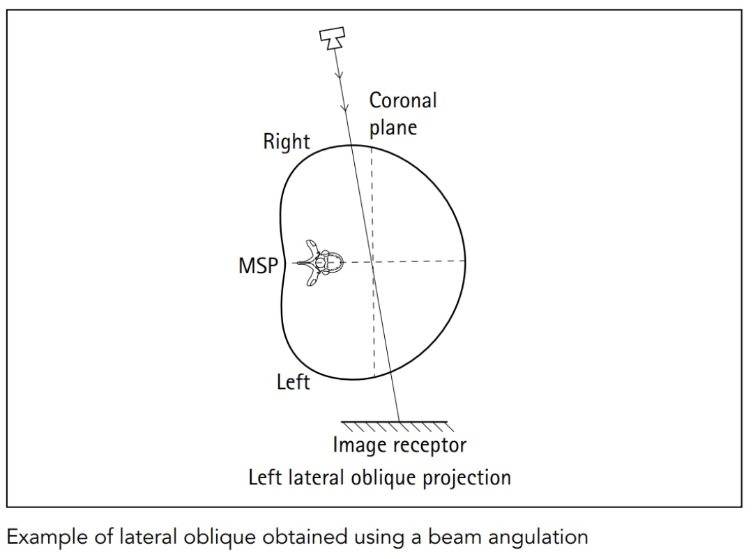 Clark's Radiography: Projection Terminology