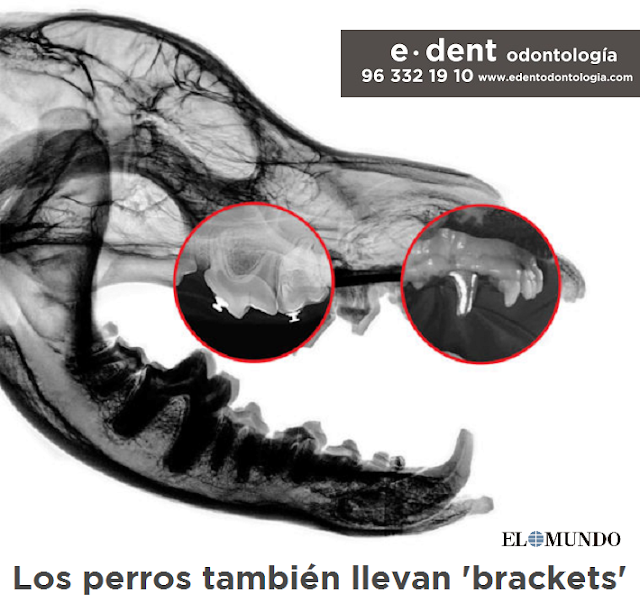 e.dent odontología: abril 2017