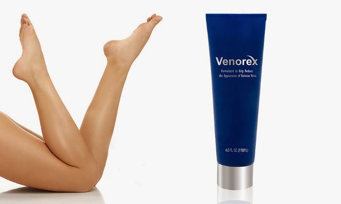 Como Eliminar Várices y Arañitas Vasculares: Venorex - Nueva Crema ...
