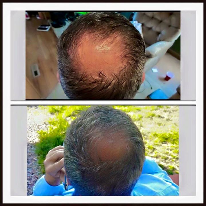 MONAT Global Revolutionary Hair Care Products: Is your hair thinning or ...