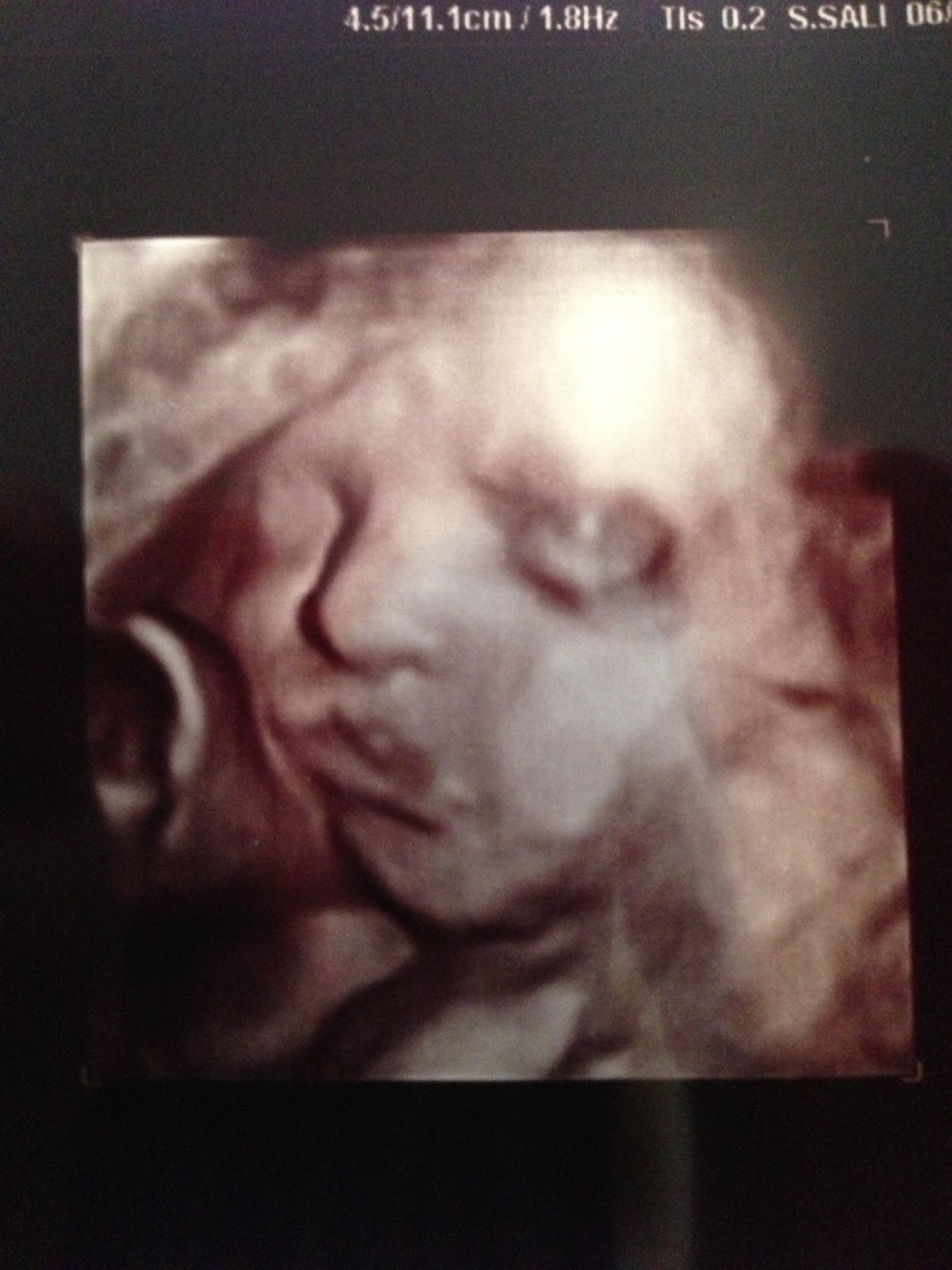 The Spurrier Family: 28 Weeks: 3D/4D Ultrasound Pictures