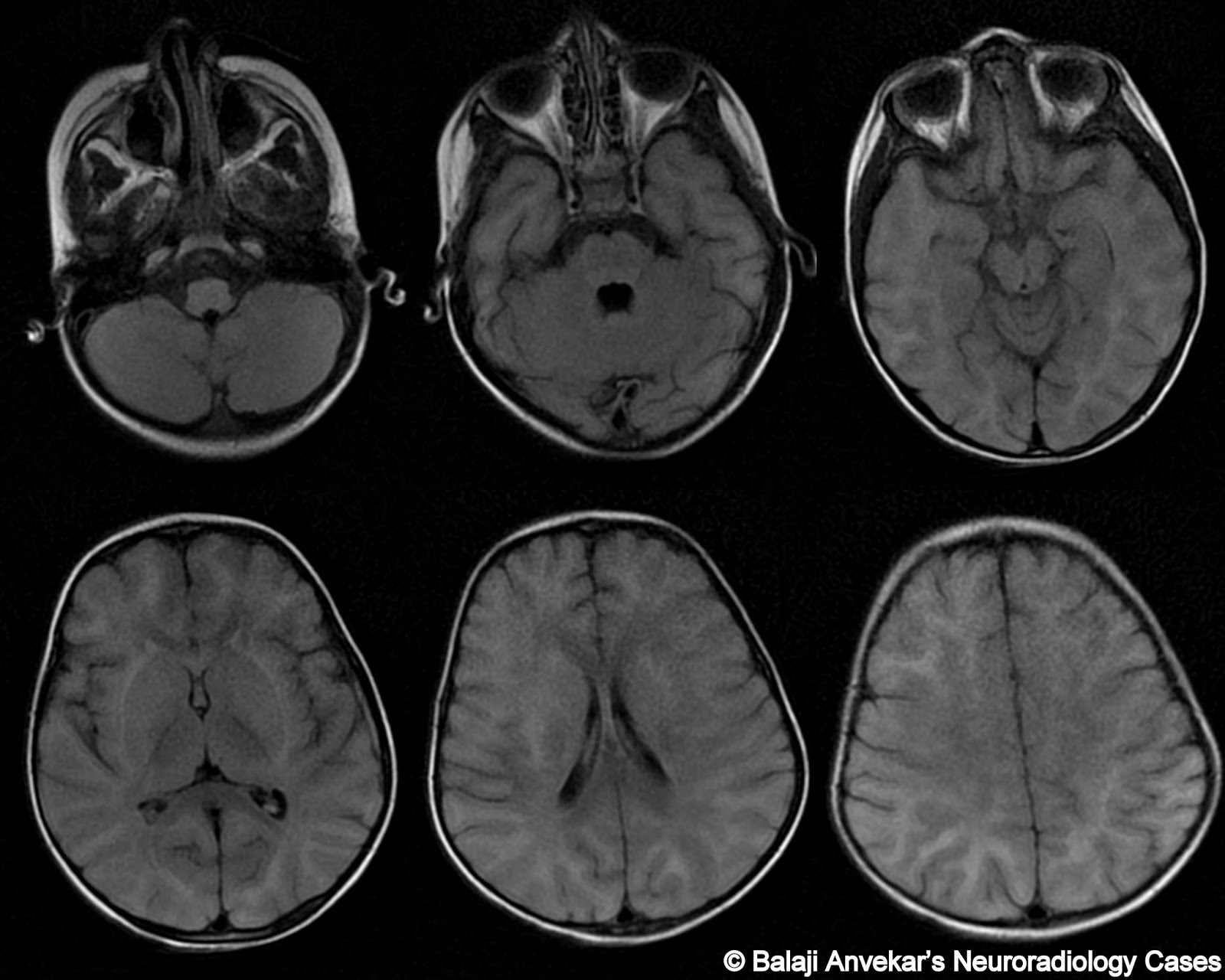 Dr Balaji Anvekar FRCR: 01/09/13 - 01/10/13