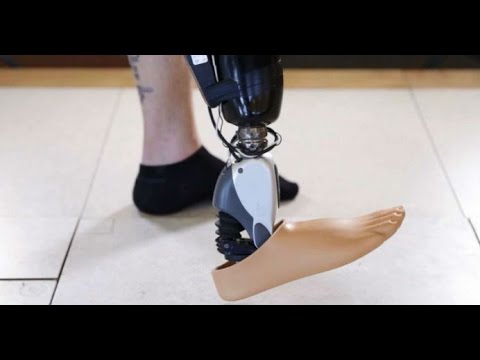 TICs de Ávaro Coronado: Prótesis Biónicas