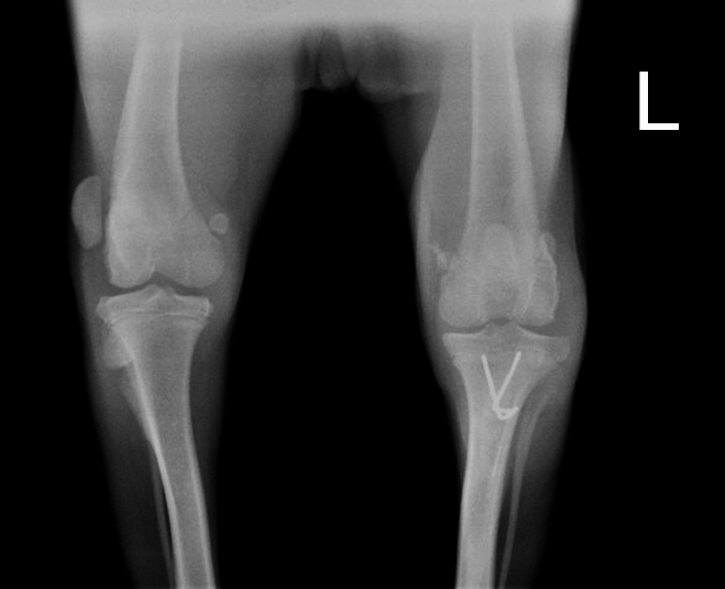 ARTROVET: Luxación lateral de rótula