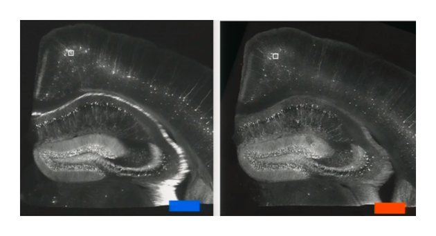 The Neurocritic: The Incredible Growing Brain!