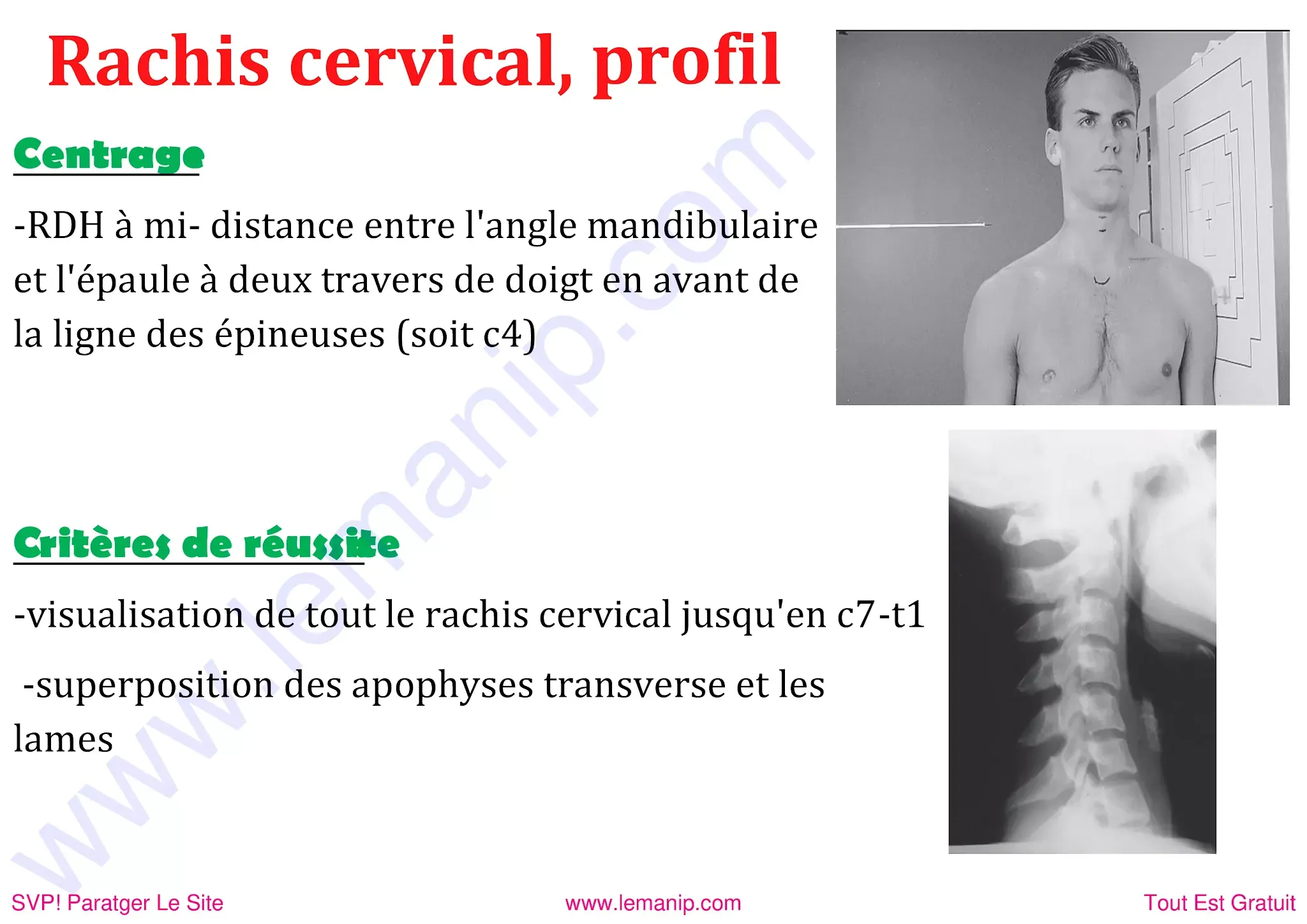 Incidences Radiologique Et Constantes Et Critères De Réussite PDF