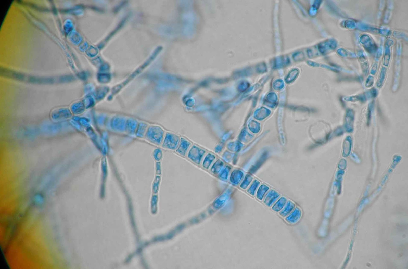 ATLAS MICOLOGIA: NEOSCYTALIDIUM HYALINUM