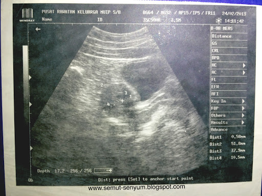 TTC's Story #4: Scan Rahim