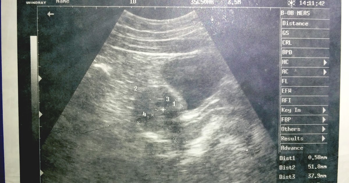 TTC's Story #4: Scan Rahim