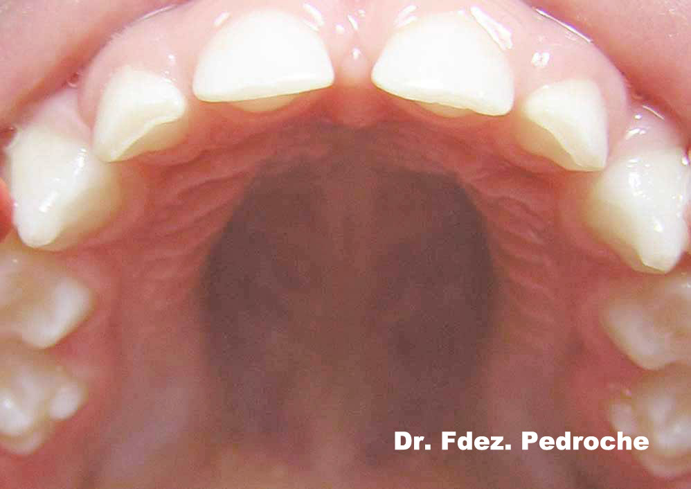 Una Boca para toda la Vida: ¿Cómo funciona la boca del lactante?