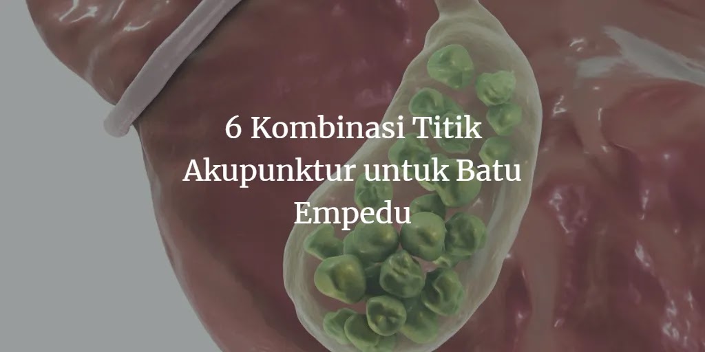 6 Kombinasi Titik Akupunktur untuk Batu Empedu - Terapi Jarum