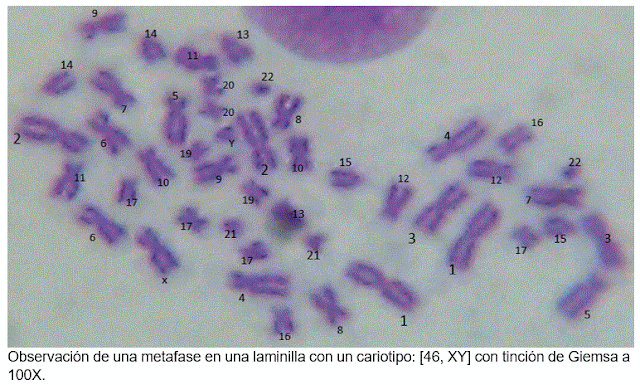 Bioquímica Diagnóstica BQD-YAI: Cariotipo humano
