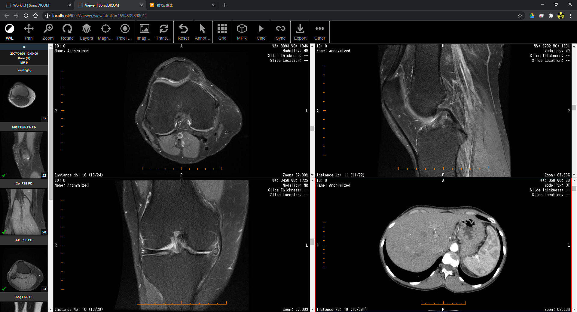 本当に使える永続無料DICOM viewerまとめ-かいわれDICOM