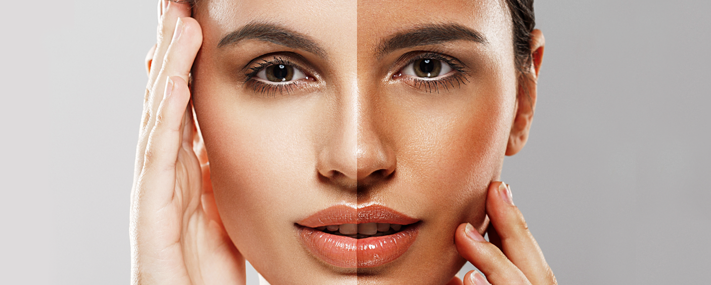 How to Even Out Tan Lines