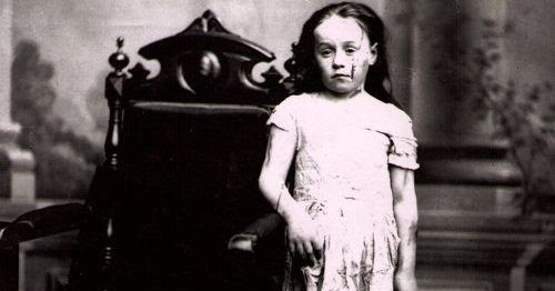 "El caso Mary Ellen, origen de la protección al menor"