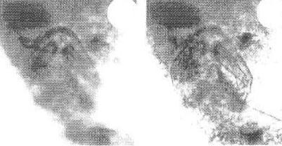 Blog de la Vida Prehistórica: Rhyniella Praecursor