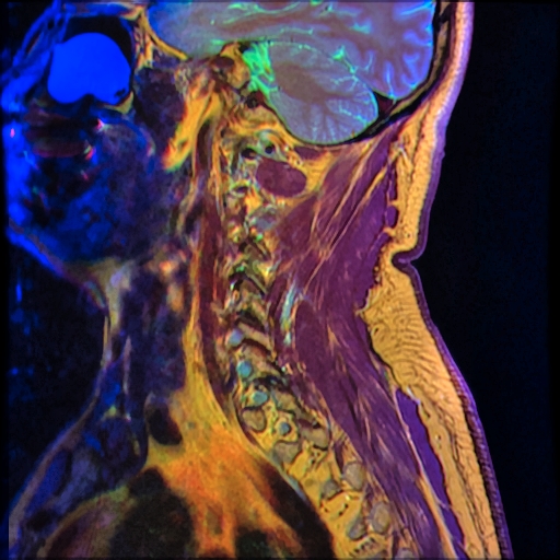 Nevit's blog: Color MRI of the Cervical verterbrae