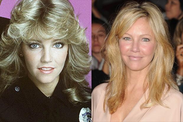 Heather Locklear Plastic Surgery