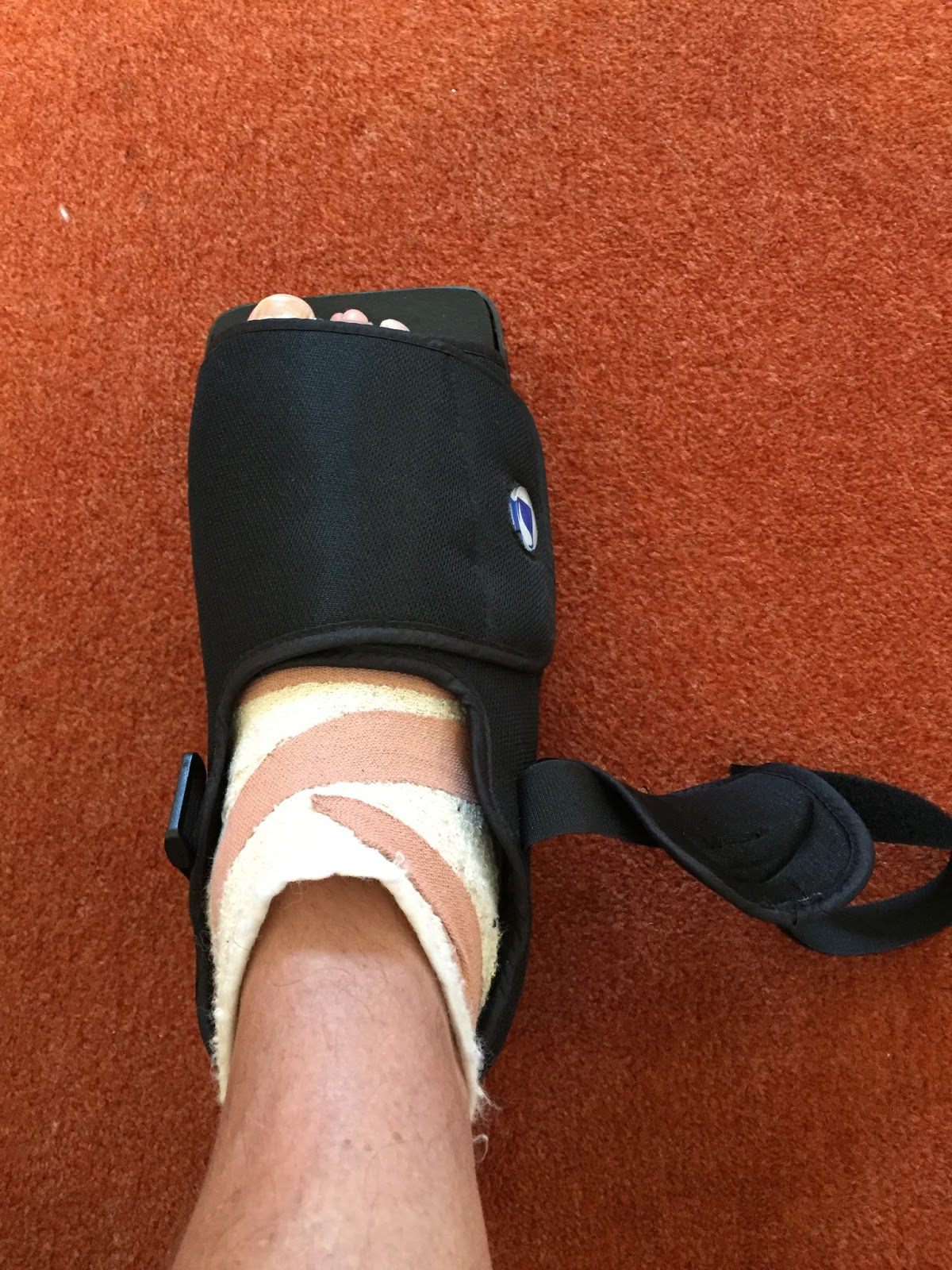 One Boot In Front Of The Other: The Cheilectomy......!!!