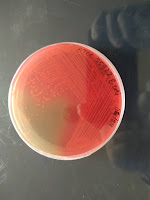 MICROBIOLOGY BLOG FOR STUDENTS (MBLOGSTU): Cultural and Biochemical ...