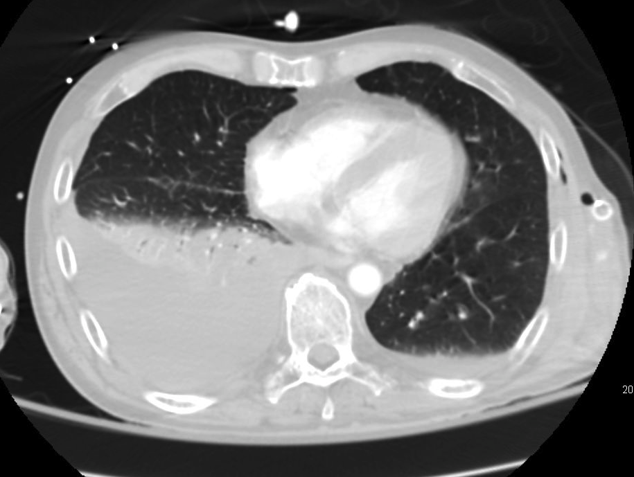 Medical Minstrel: Gen Surg: Radiology lessons