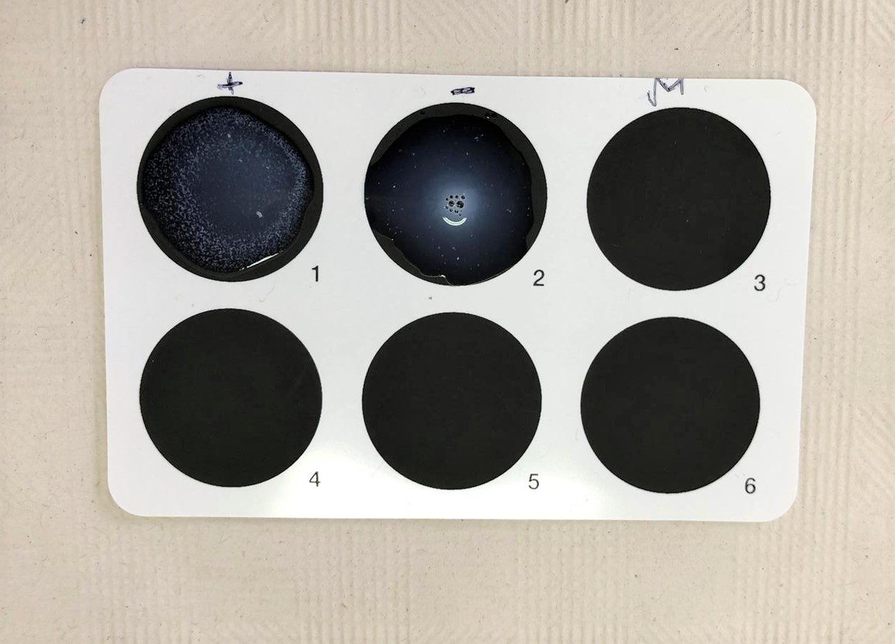 Práctica 4. ASO-Latex. Aglutinación en tarjeta 15/10/2019