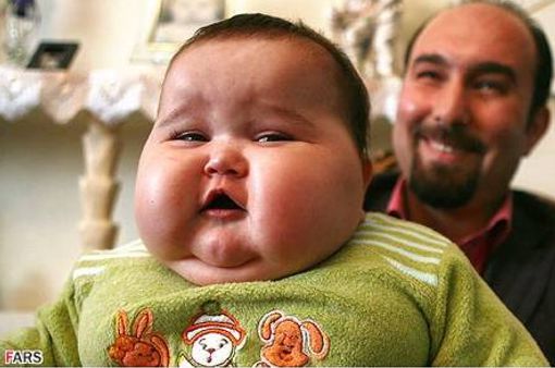 Locura medica: MACROSOMÍA FETAL