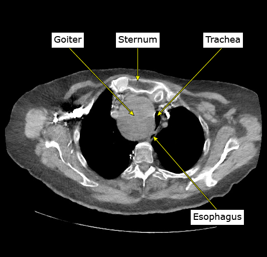 EL RINCÓN DE LA MEDICINA INTERNA. juanpedromacaluso@yahoo.com.ar: 20 ...