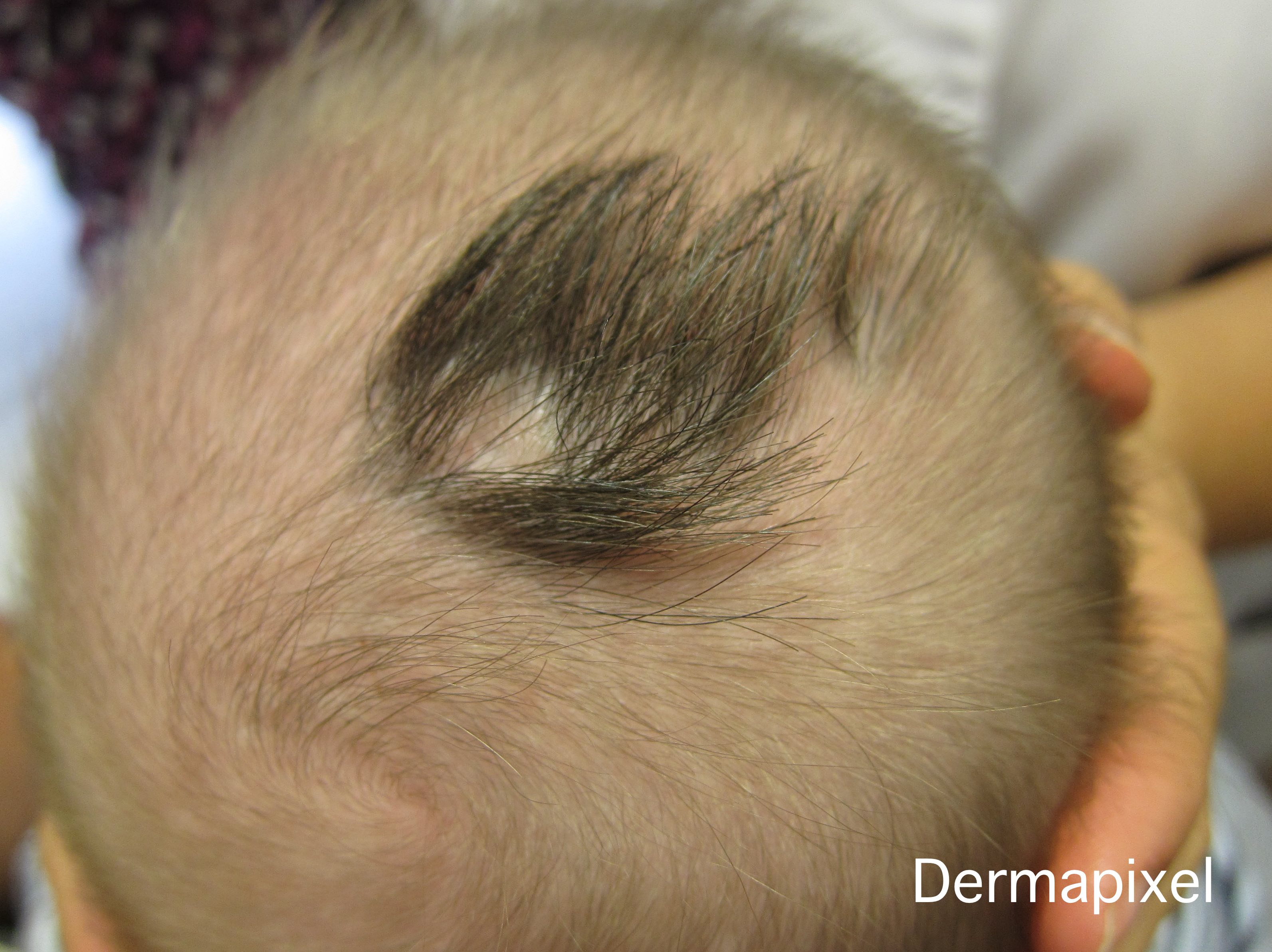 Dermapixel: mayo 2021