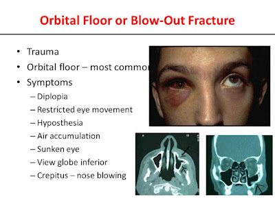 EXAMS AND ME : Vision 2020: Tear Drop Sign