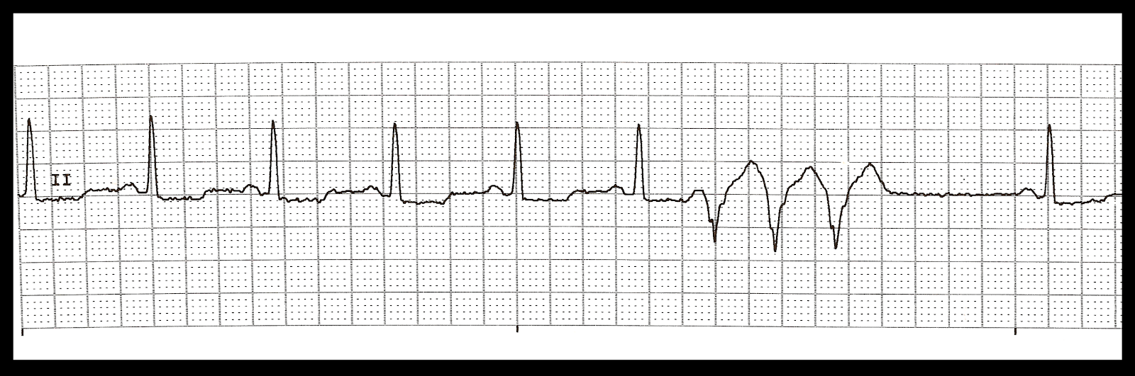 Practice EKG Strips 314