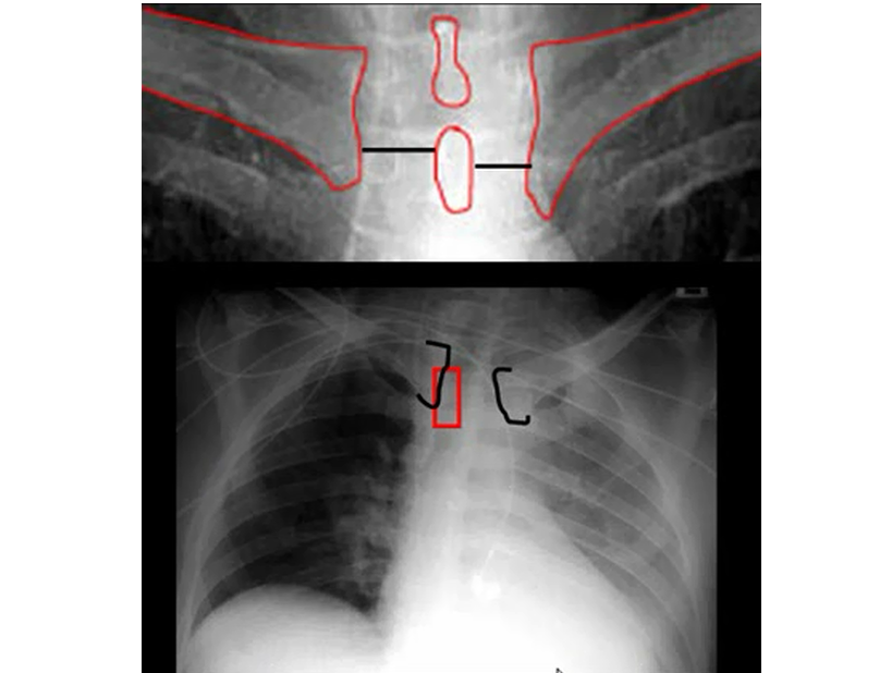 Positioning and Related Anatomy for X-ray Imaging
