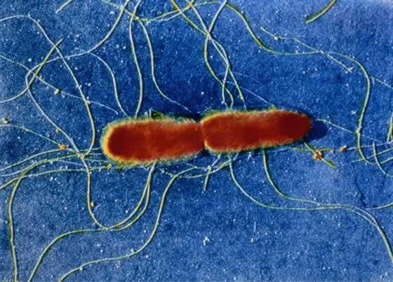 BIOSEGURIDAD Y BIOCUSTODIA: Laboratory-acquired scrub typhus and murine ...