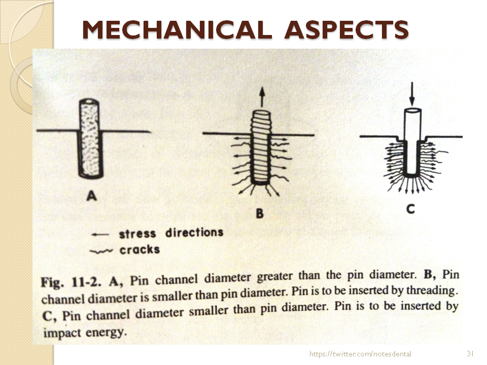 Dental Notes: Pin Retained Restorations NOTES