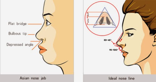 Flat Nasal Bridge And Epicanthal Folds - CHAPTER 13: HEAD, FACE, NECK ...