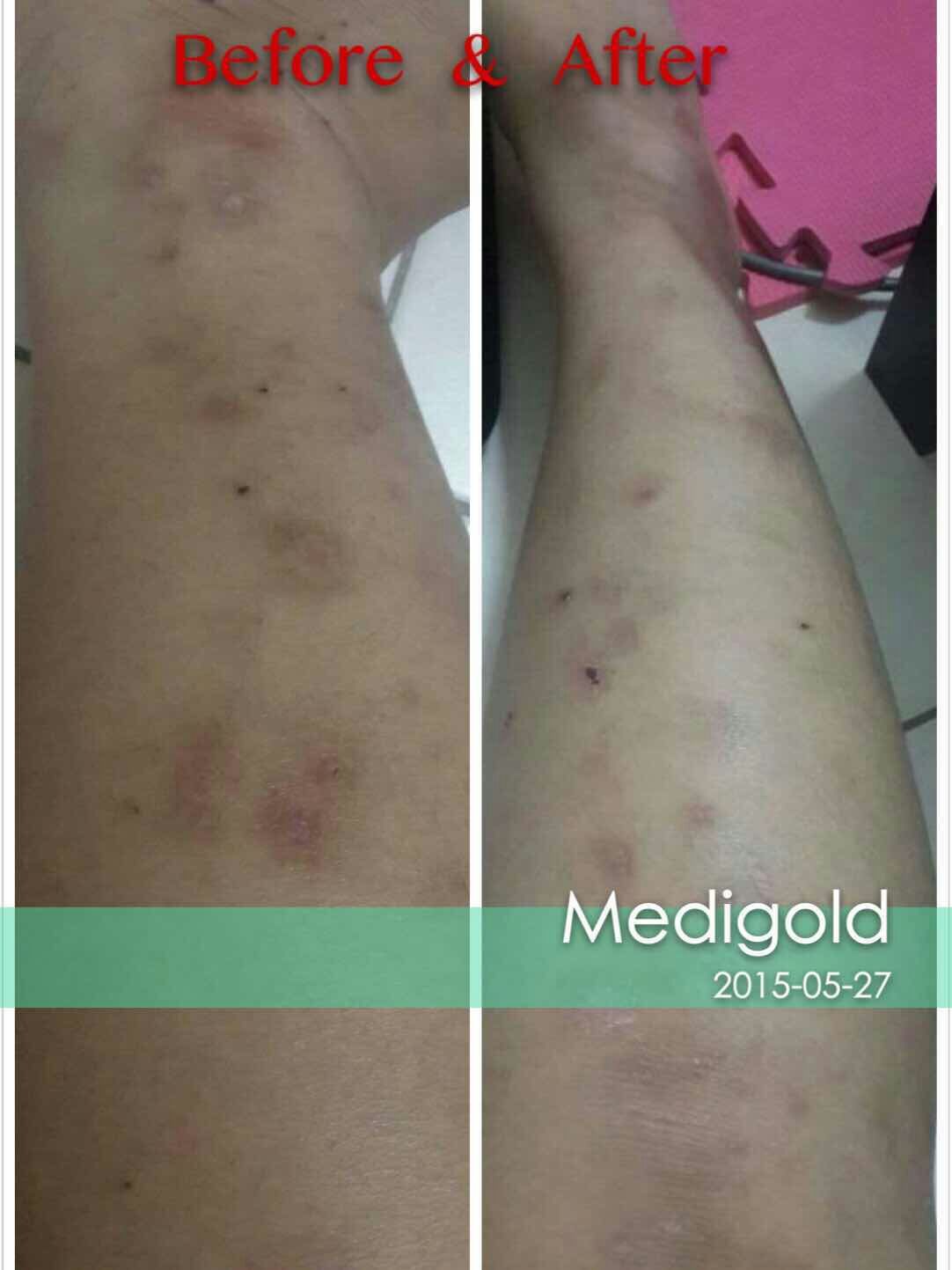 Malaysia Return Legacy Products(reviewed/explained)- Redoxy, Medigold ...