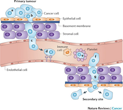 Cuéntame de Ciencia: La metástasis del cáncer.