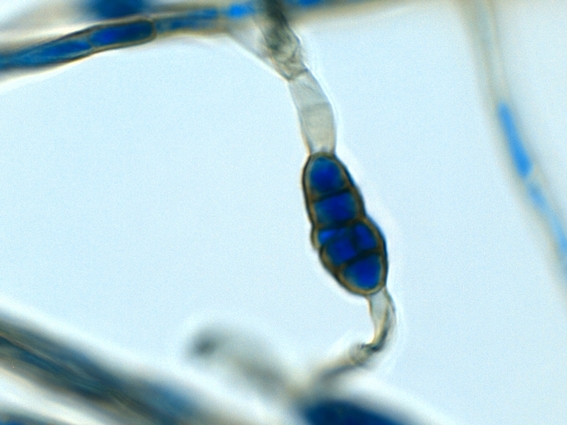 Fun With Microbiology (What's Buggin' You?): Pithomyces species