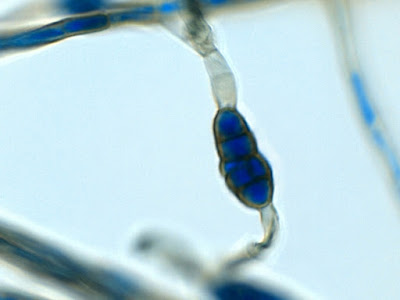 Fun With Microbiology (What's Buggin' You?): Pithomyces species