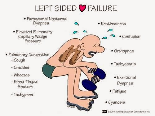 50 Shades of Green: Focus On: Left Ventricular Failure (LVF)