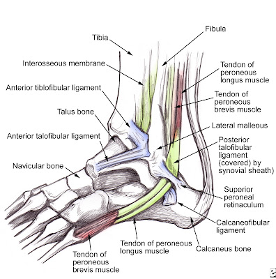 El Blog de Isa y Juan: Tendinopatia calcificante de tendón peroneo ...