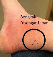 Anim Agro Technology: LIPAN DAN LIPAN BARA