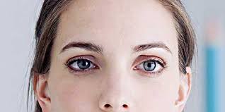 3 Langkah Sederhana Mengatasi Mata Juling Tanpa Obat - Sehat Alami