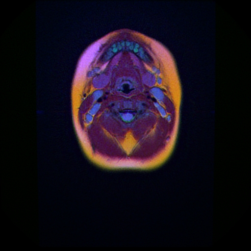 Nevit's blog: Color MRI of the BRAIN