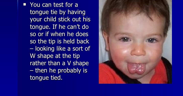 A Mother Matter: Effects of a Mutation