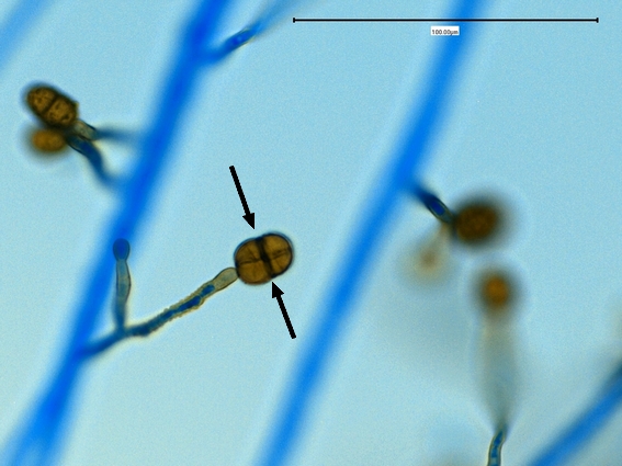 Fun With Microbiology (What's Buggin' You?): July 2015