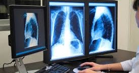 RADIOLOGIA PARA ESTUDANTES: TÉCNICAS RADIOGRÁFICAS DO KV E MAS